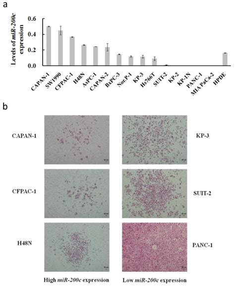 The Levels Of Mir 200c Expression In Cell Lines And The Correlation Of