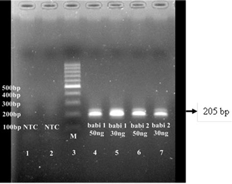 Visualization Of Amplified DNA By PCR Replication Non Template