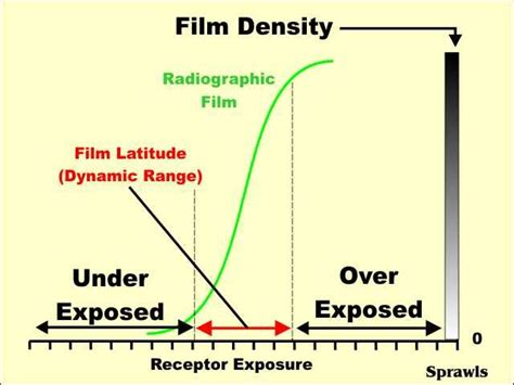 Digital Radiography Digital Radiography Radiography Digital Image