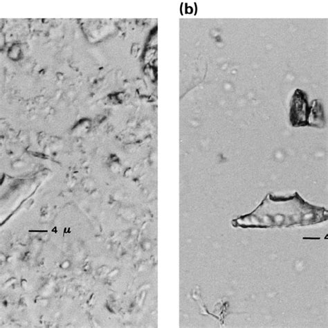 Lateral View Of A A Phytolith From Pit F9 And B A Modern Musa Download Scientific Diagram