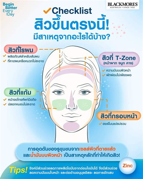 อิงดอยเพลส สิวขึ้นตรงนี้ มีสาเหตุจากอะไรได้บ้าง อิงดอยเพ