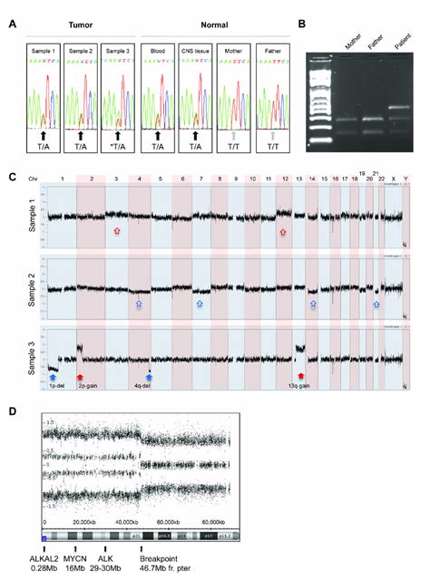 Molecular Analysis Of The Alk Gene And Genomic Profiling With Snp Download Scientific Diagram