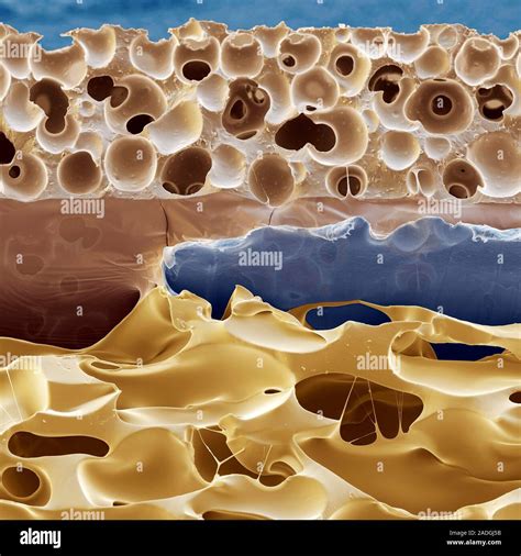 Wound Dressing Coloured Scanning Electron Micrograph Sem Of
