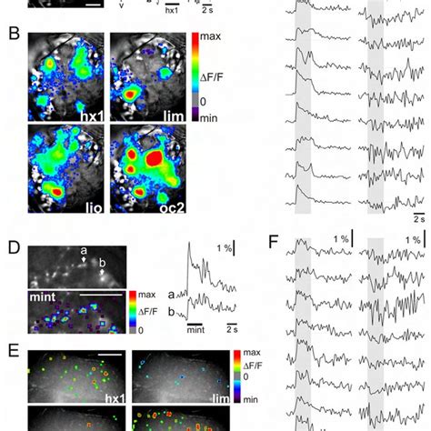Immunofluorescence Staining With Anti Synapsin In Brains From A