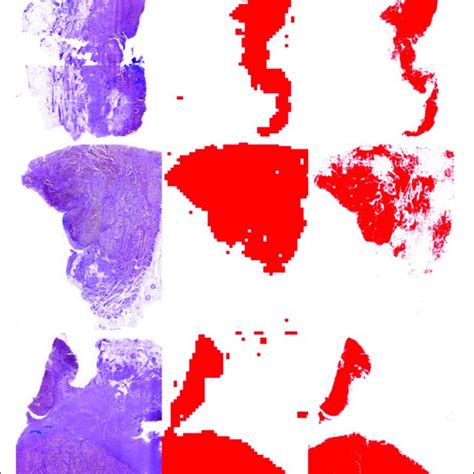 Tumor Segmentation Results With The Instance Classifier And U Se Net