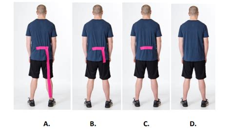 Sciatica Series 11 1 Sign Your Sciatica Is Getting Better Or Getting