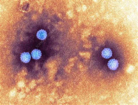 Polyoma Virus Particles Tem Stock Image M0501230 Science Photo