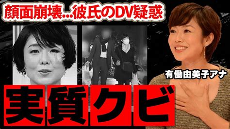 【news Zero】有働由美子アナの降板が実質クビの真相大怪我で顔面崩壊した本当の理由に驚愕！熱愛彼氏のdv疑惑の実態がヤバすぎた