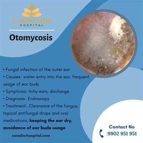 Otomycosis • Fungal Infection Of The Cavalier Hospital