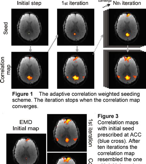 Figure 1 From Adaptive Seeding For Resting State Network Correlation Analysis With Empirical