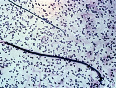 Mansonella Streptocerca Saúde Blog Opas