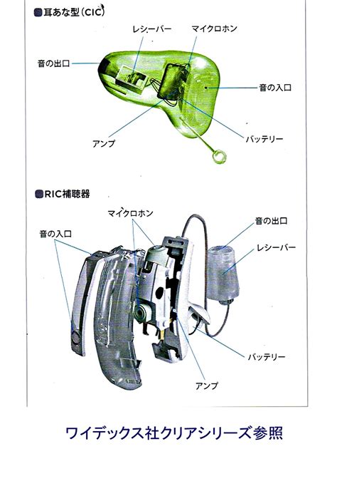 意外と知られていない補聴器の「構造」 ナショナル補聴器センター