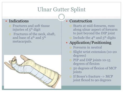 Ulnar Nerve Gutter Splint At Martha Ansley Blog