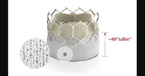 Tavr Outperforms Savr When Treating Women Historic All Female Trial
