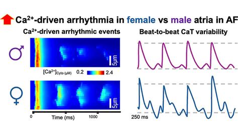 Opencarp Personalized Computational Model Of The Heart Examines Cardiac Rhythm Siam