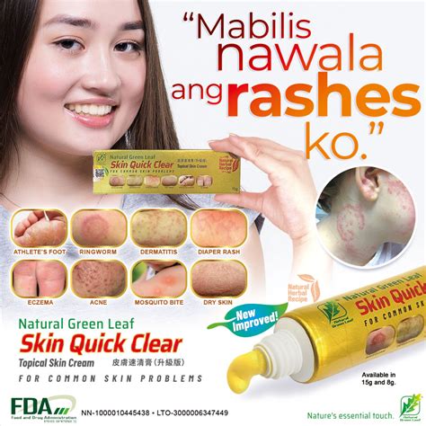 Ngl Skin Quick Clear Topical Skin Cream 15g Shopee Philippines