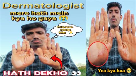 Main Bahut Dino Sa Is Bimari Se Pareshan Ho 🥹 Please Help Me Guys 🙏🏻