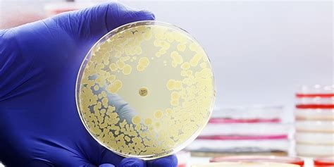 Farmaci Scoperto Nuovo Antibiotico Efficace Contro I Batteri Resistenti Medicina Interna