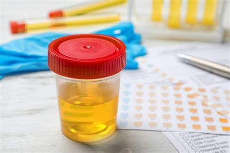 Ecbu En Quoi Consiste Cet Examen Des Urines