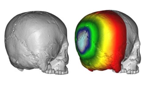 Ancient Humans Deformed Their Skulls For Sake Of ‘group Identity