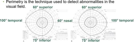 Visual Field Testing In Glaucoma Flashcards Quizlet
