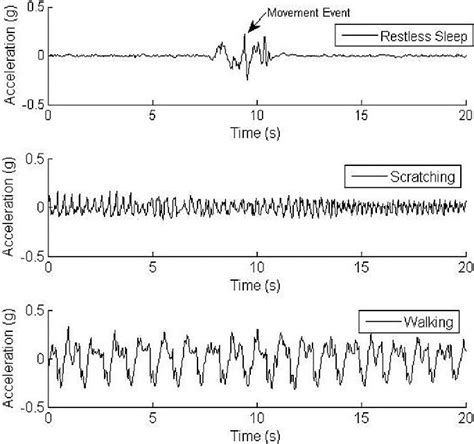 Figure 2 From Actigraphy Based Scratch Detection Using Logistic