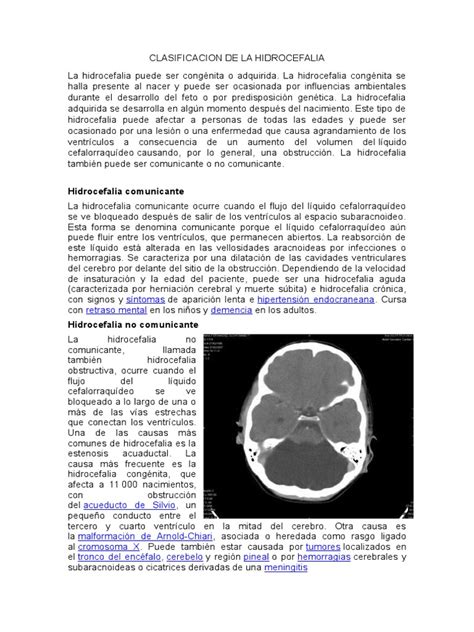 Clasificacion De La Hidrocefalia Medicina Medicina Clinica