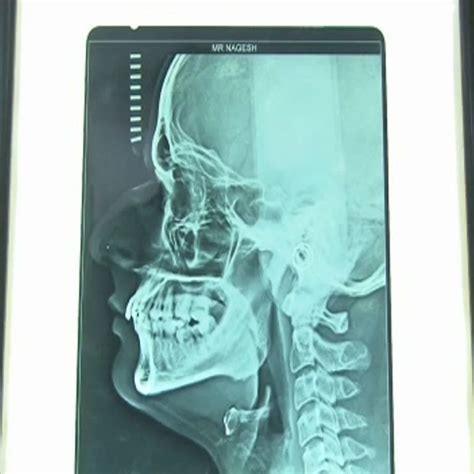 Dental Cephalometric Projection At Best Price In New Delhi By Tonisha