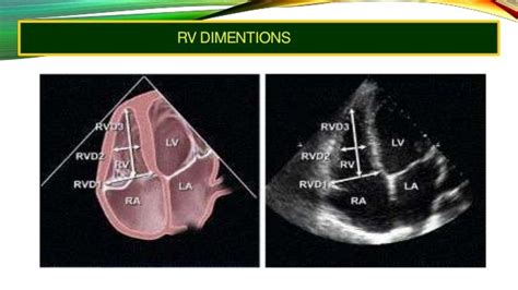 Echo Assesment Of Rv Function