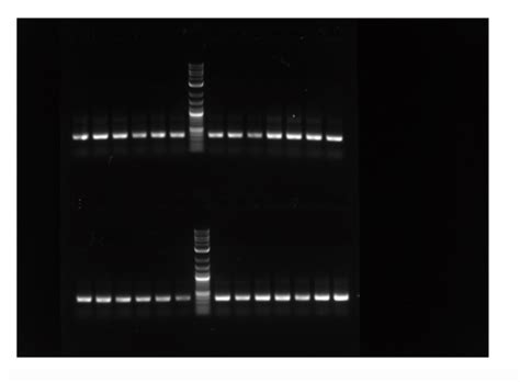 Does The Non Specific Amplification Affect 16s Miseq Library Researchgate