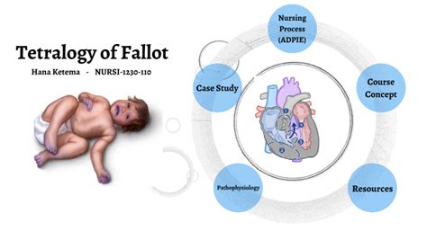 Tetralogy Of Fallot Concept Map By Hanna Jett On Prezi
