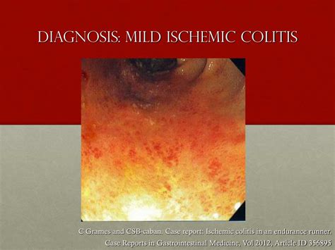 Ppt Colonic Ischemia What Really Matters Powerpoint Presentation