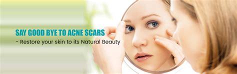 Best Skin Specialist Dermatologist Skin Doctor In Mohali