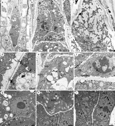 Electron Micrographs Showing The Ultrastructure Of The Seven Celled