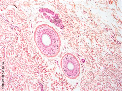 Histology Of Human Tissue Show Epithelial Tissue And Connective Tissue