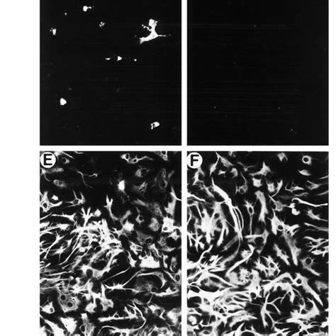 Selective Elimination Of Microglia From Mixed Hippocampal Cultures A Download Scientific