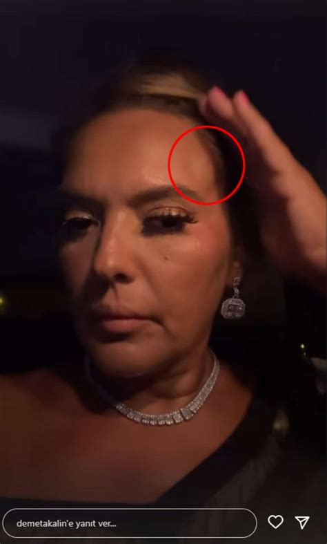 Demet Akalın Tekne Kazası Geçirdi Nasıl Sağ çıktık Algılayamıyorum