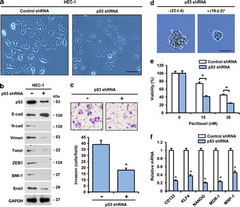 Knockdown Of Mutant P53 In Ec Cells Causes A Reversal Of Emt And