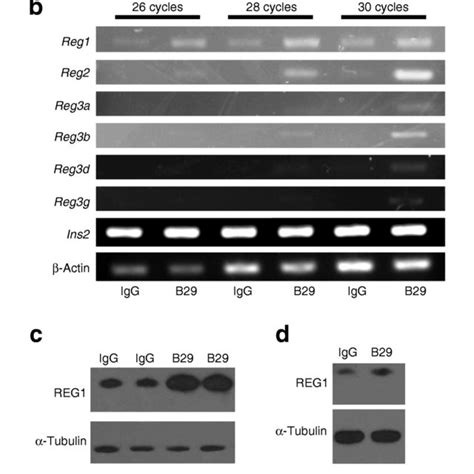 Reg Gene Expression Is Upregulated In Pancreatic Islets Following