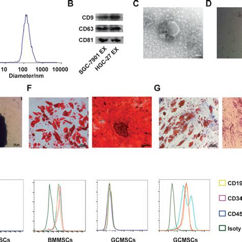 Identification Of Exosomes In Gastric Cancer Gc Cells And Primary