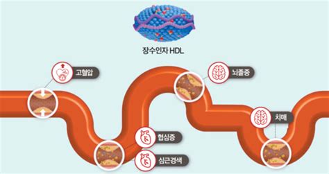 건강한 우리집 ‘혈관 청소차 Hdl 콜레스테롤 수치 높으면 100세 건강 유지 중앙일보