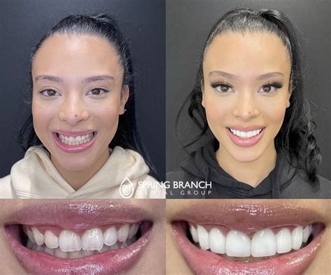 Smile Gallery Spring Branch Dental Group