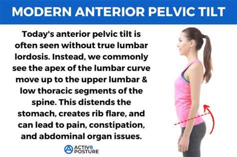 Anterior Pelvic Tilt Activ8 Posture