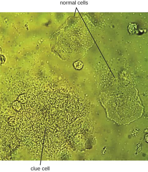 Bacterial Infections Of The Reproductive System Microbiology
