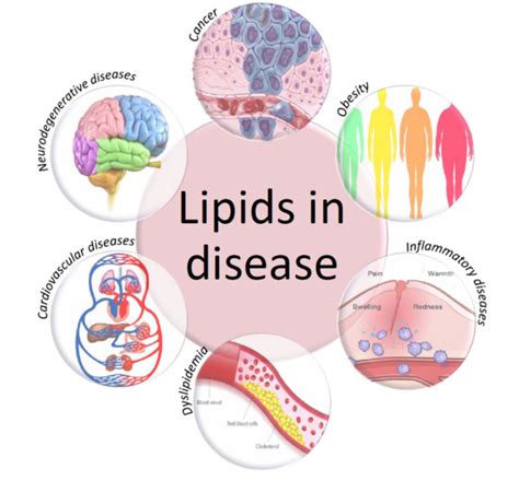 Ijms Free Full Text Lipids And Lipid Processing Pathways In Drug