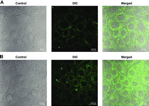Confocal Microscopy And Differential Interference Contrast Dic Images Download Scientific
