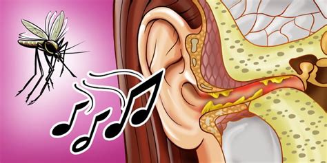 Why Mosquitos Sing Near Your Ears And How You Can Avoid It