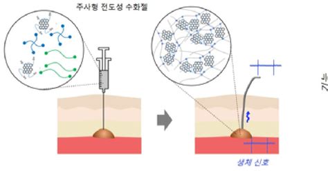 부작용↓ 활용도↑ 체내 이식형 전극 개발