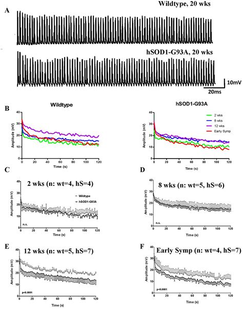 Development Of Abnormalities At The Neuromuscular Junction In The Sod1 G93a Mouse Model Of Als