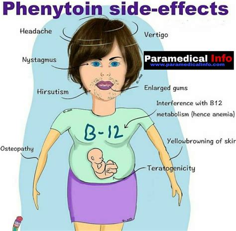 Phenytoin Side Effects Medical School Essentials Medical School Life